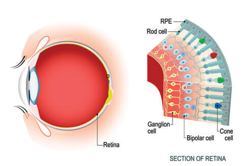 Diabetic Retinopathy | Dakota Eye Institute | Retinal Care Bismarck